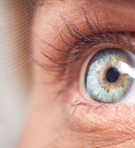 Cataract Resources | SpaMedica